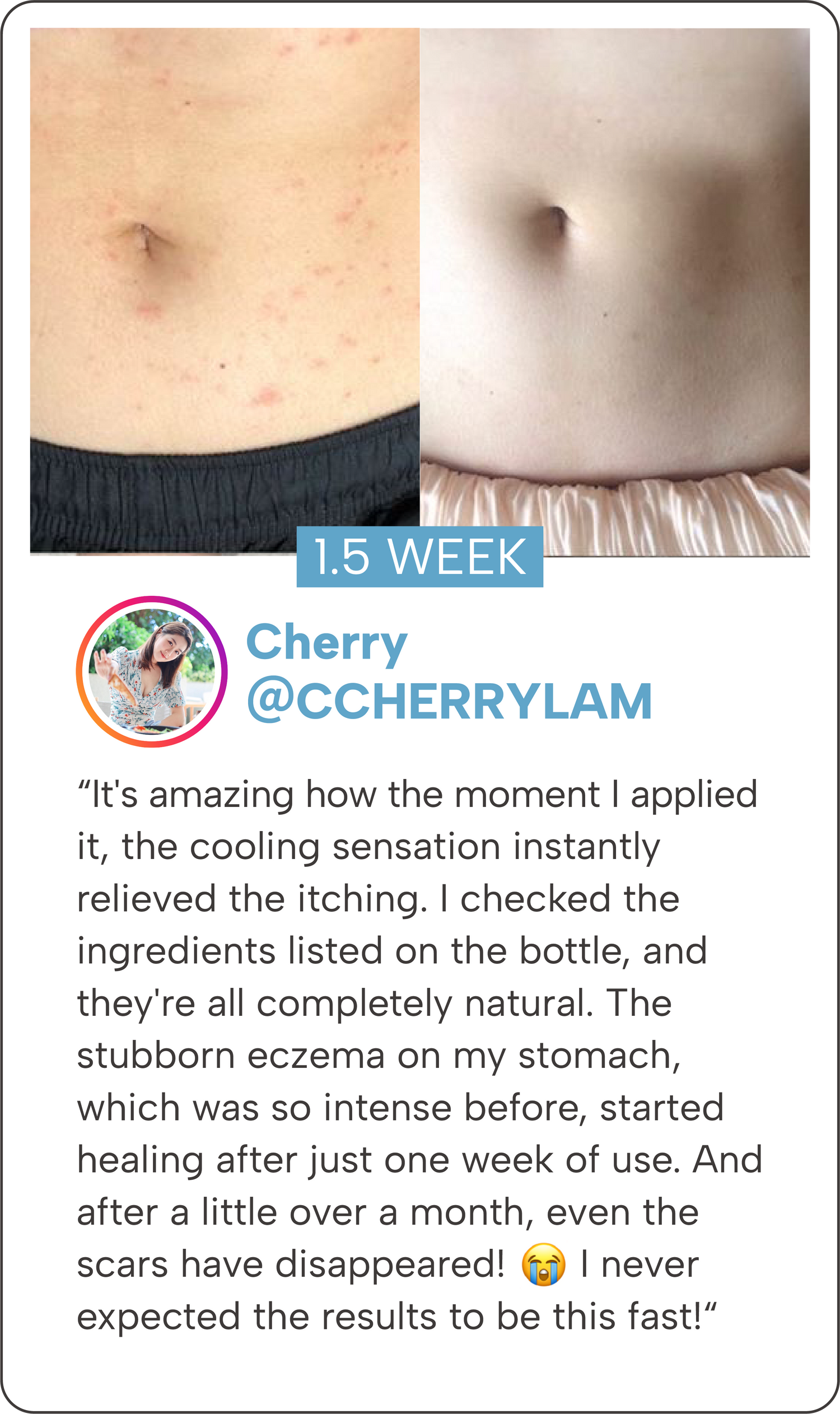 CUBED SKINCARE | Eczema, Dermatitis Atopic, and Psoriasis Relief – CUBED LIMITED