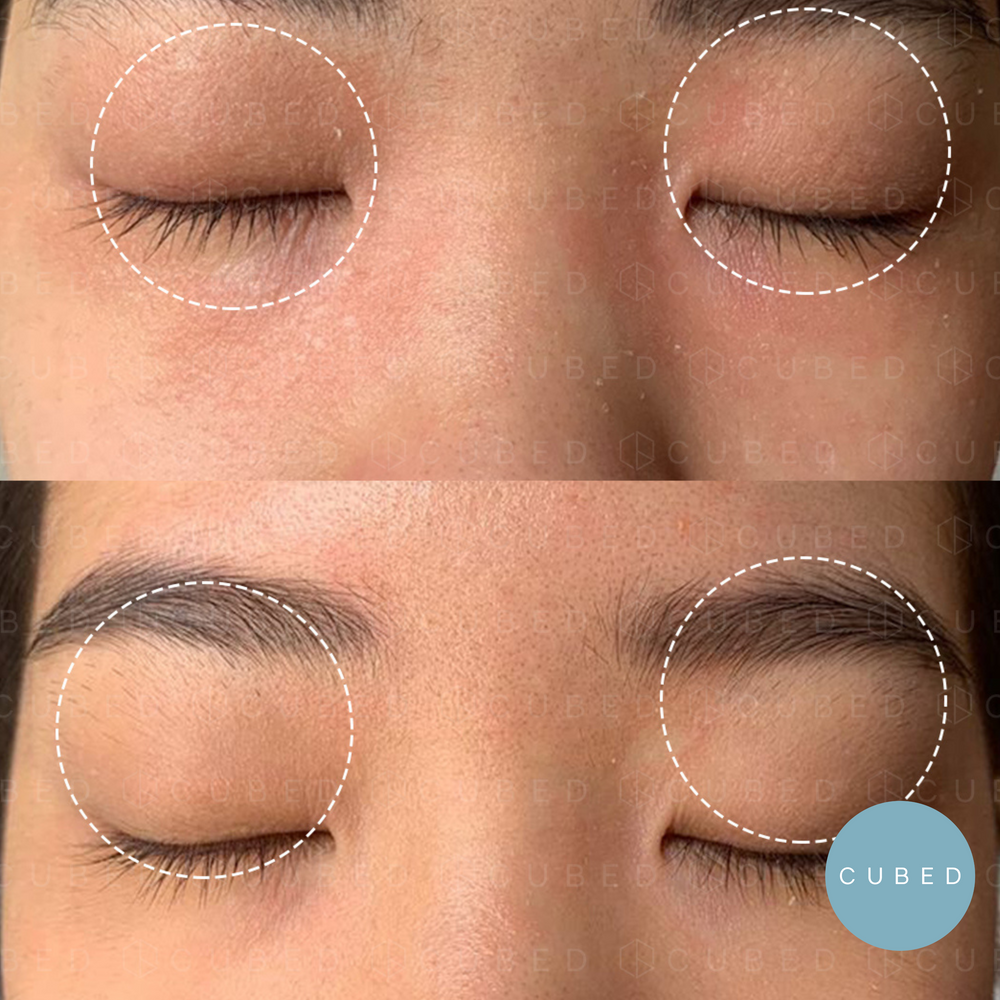 Cubed 真實用家回圖 - 濕疹肌、暗瘡肌、敏感肌 – CUBED LIMITED